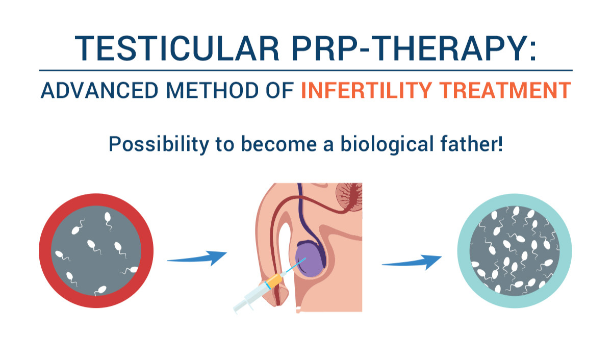 Intratesticular PRP injection | iVF Riga